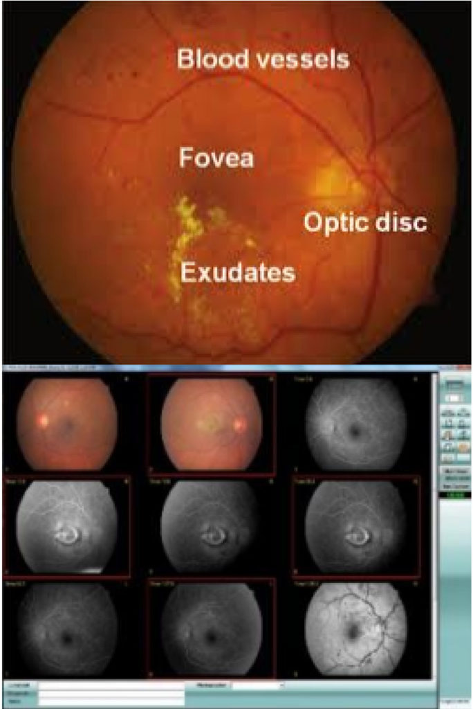 DoktorSays Tele-Retinal Tarama Çözümleri – New Vision