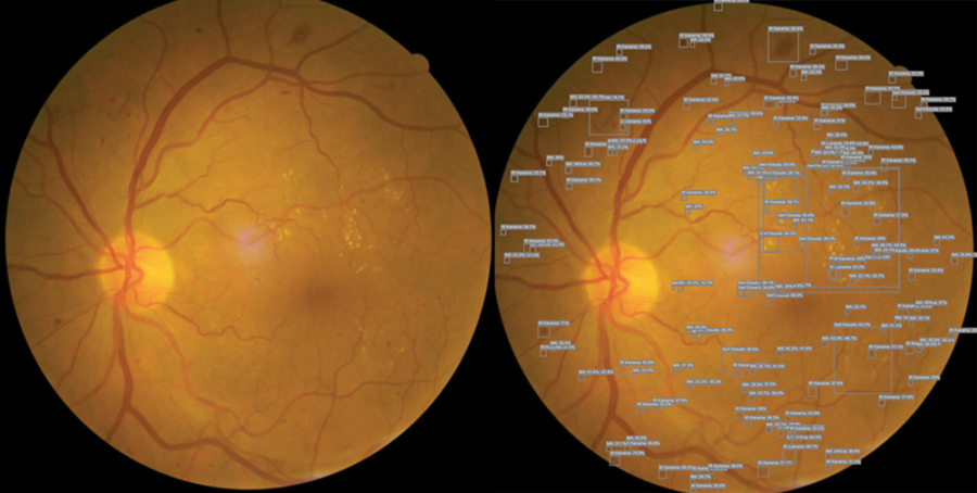 XuLabel – Yapay Zekayı eğitmenin kolay yolu – New Vision FUNDUS